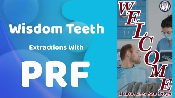 Wisdom Teeth Removal with PRF | Dental Arts San Diego | Vlog