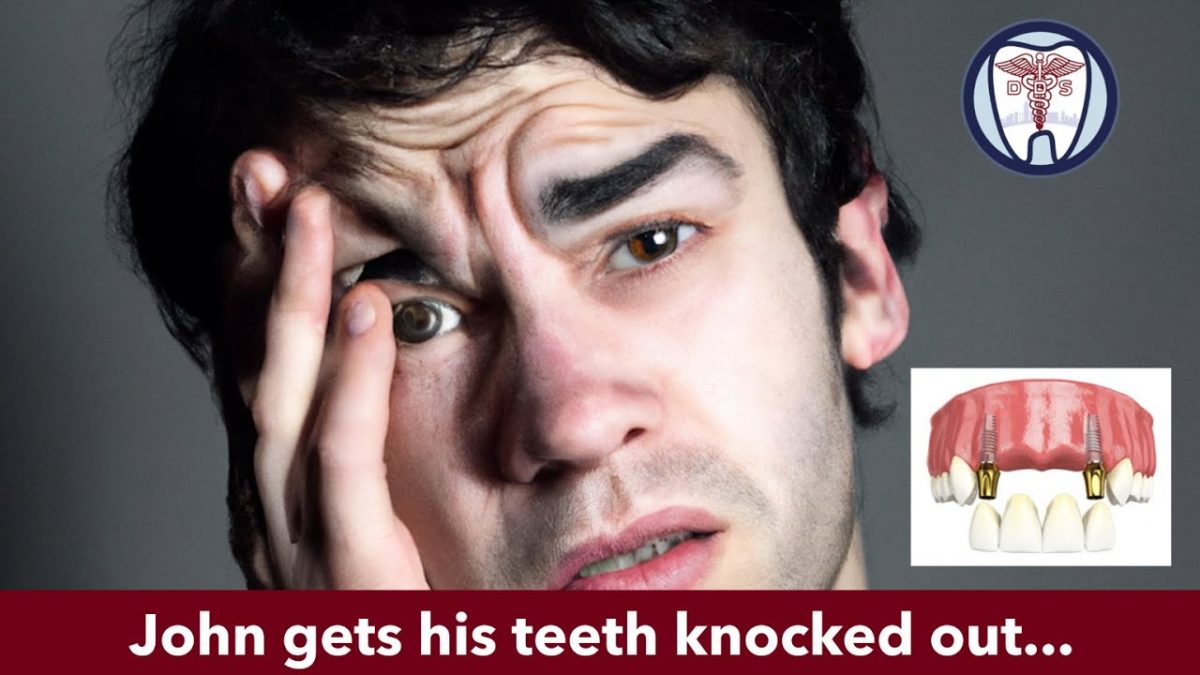 John Gets His Teeth Knocked Out... | Dental Arts San Diego | Vlog