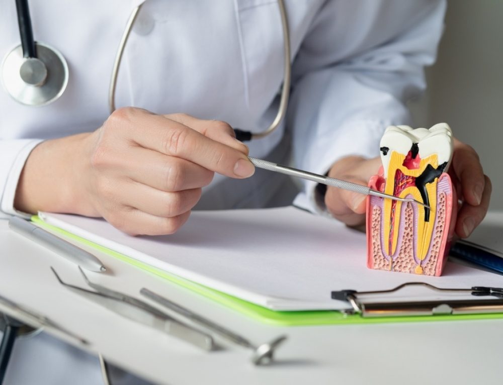 10 Tips to Reduce Swollen Gums at Home - Dental Arts San Diego
